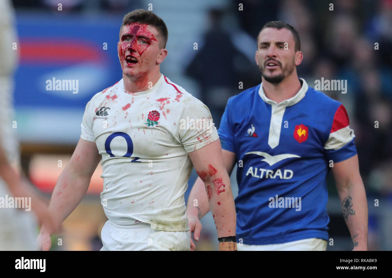 Tom curry with blood injury hi-res stock photography and images - Alamy