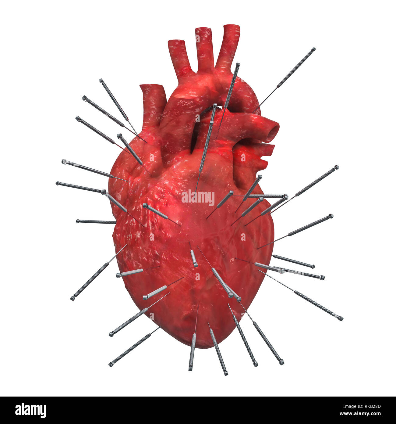 Human heart with acupuncture needles. Acupuncture treatment of heart ...