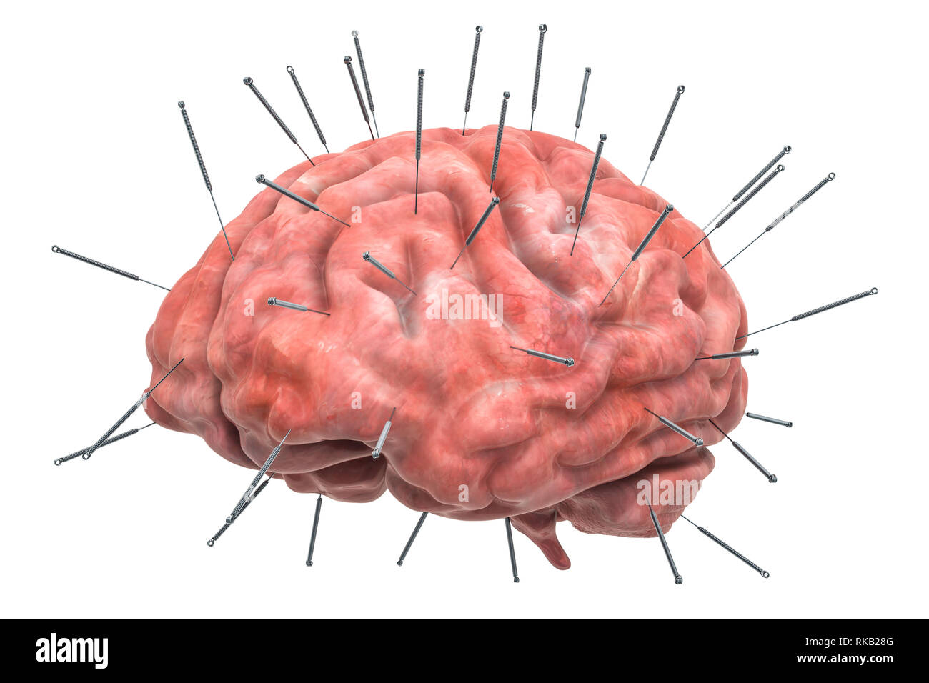Human brain with acupuncture needles. Acupuncture treatment concept, 3D ...
