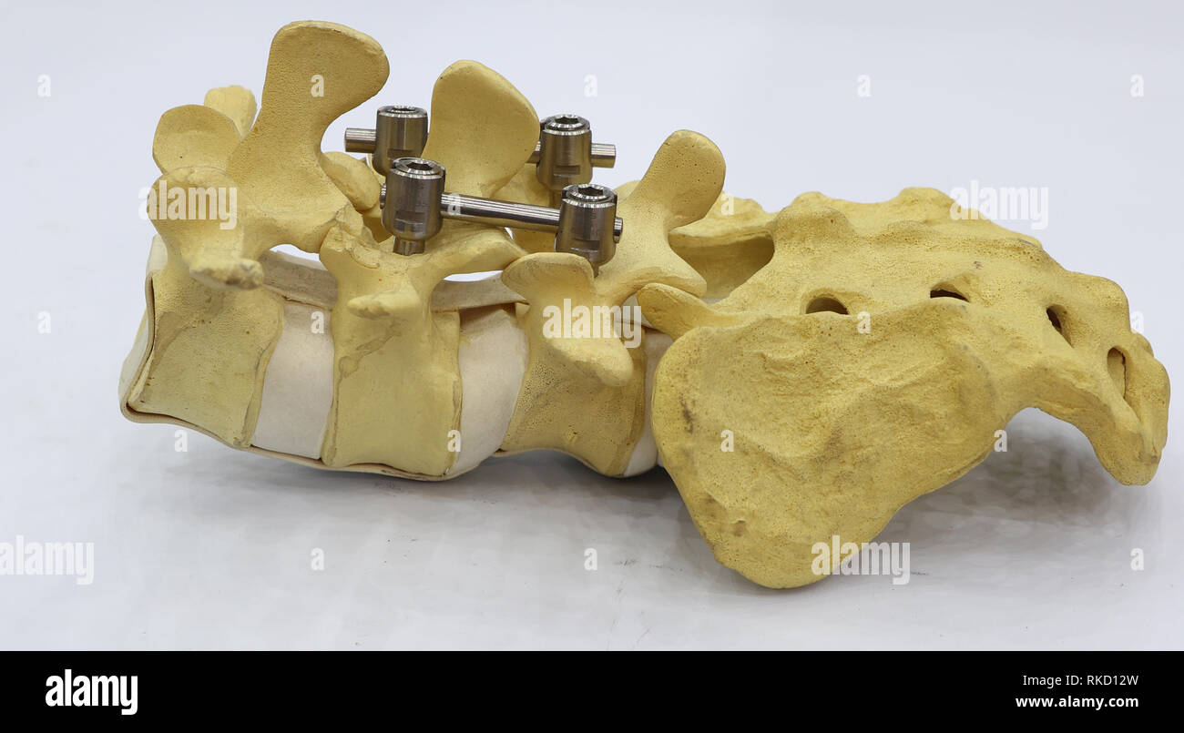 Spinal column close up hi-res stock photography and images - Alamy
