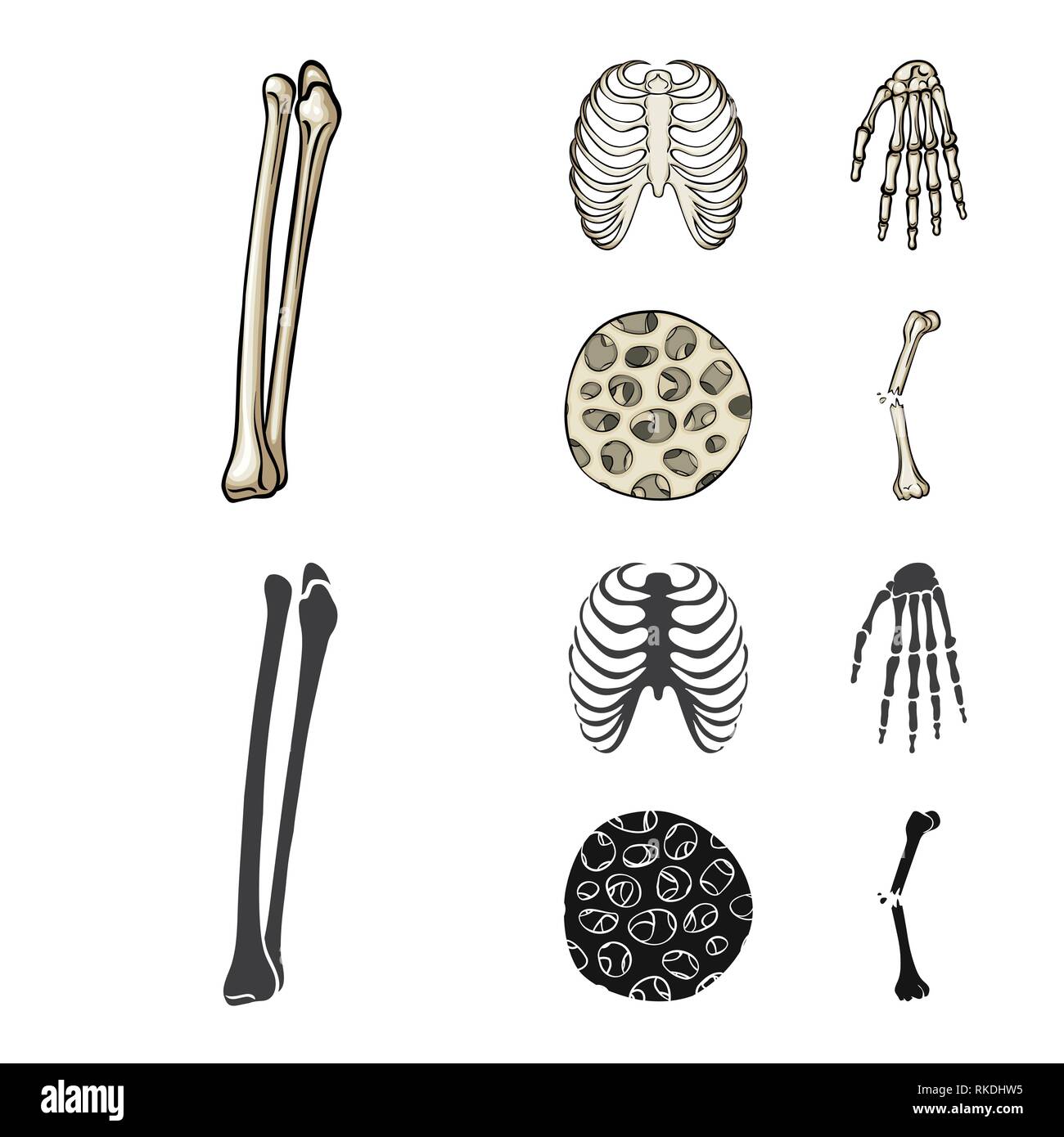 femur,rib,wrist,fiber,fracture,cage,hand,healthy,pain,leg,xray,calcium ...