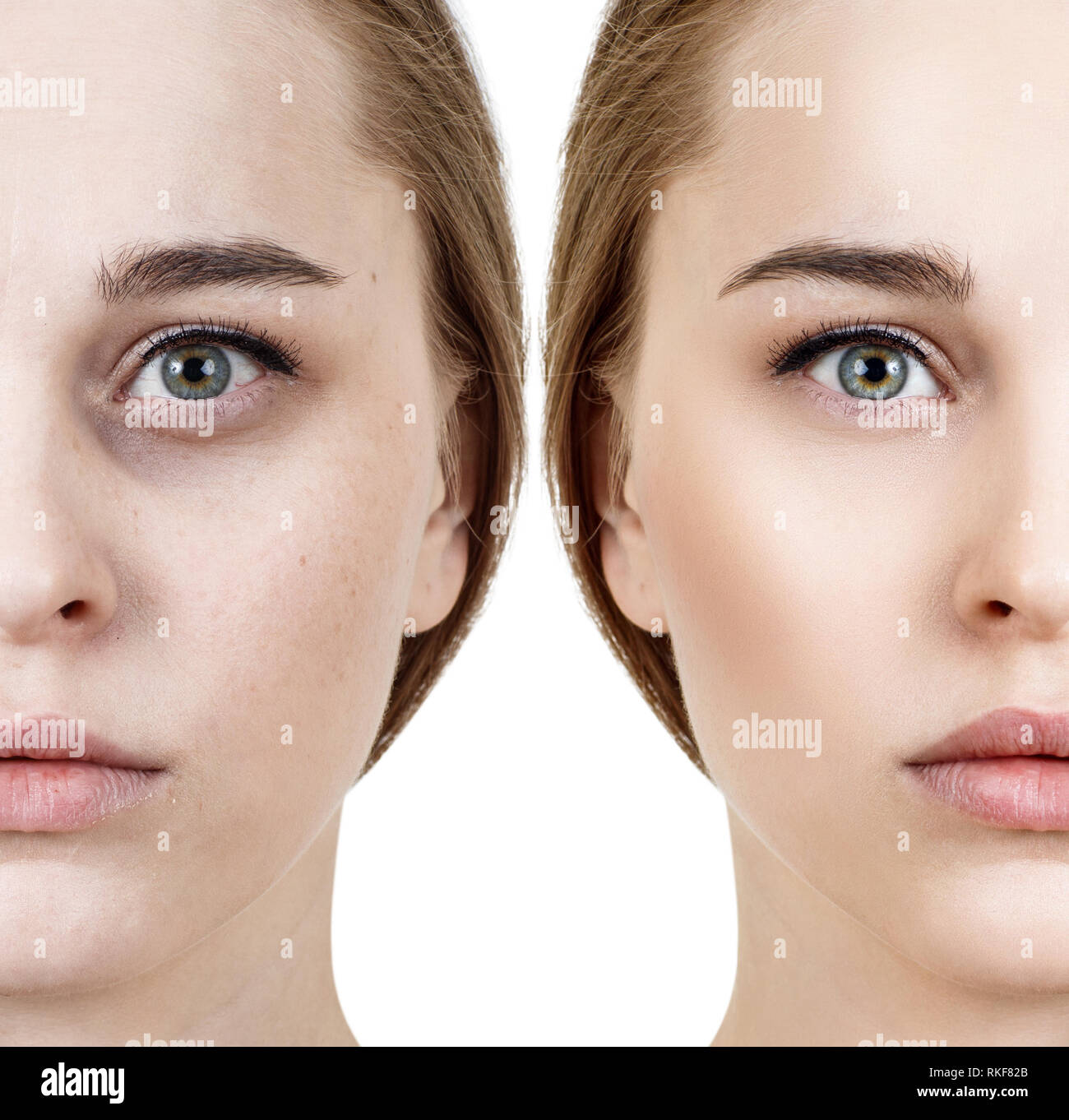 Using Fake Bruises Makeup