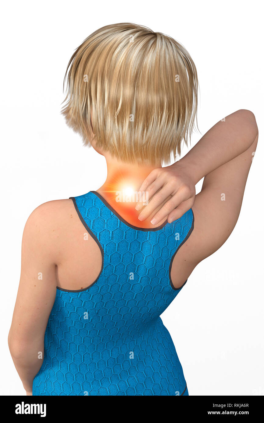 What Causes Muscle Contractures