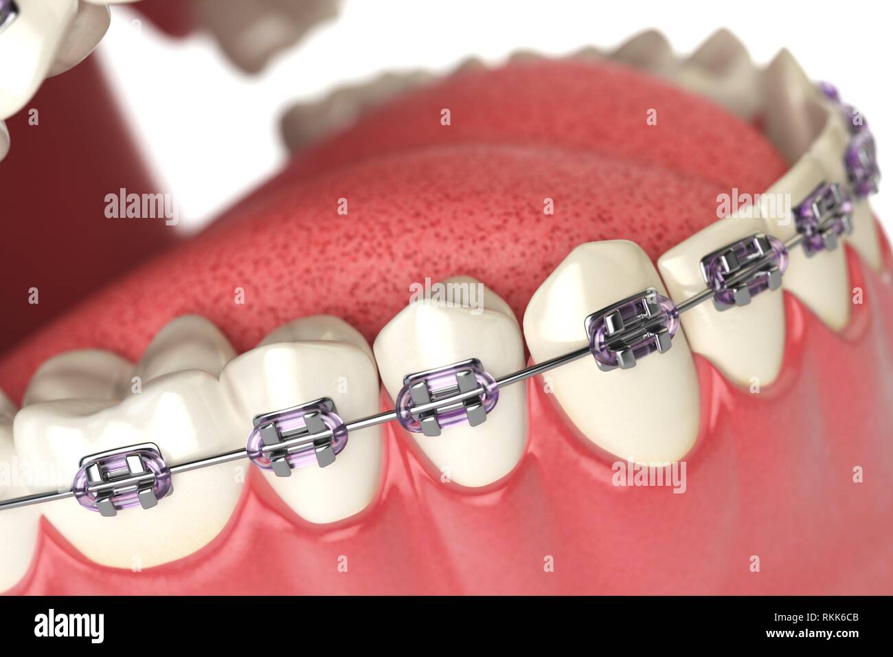 Open Bracket High Resolution Stock Photography and Images - Alamy