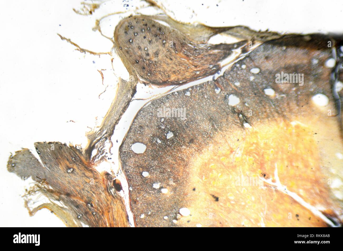 Neuron cell body micrograph hi-res stock photography and images - Alamy