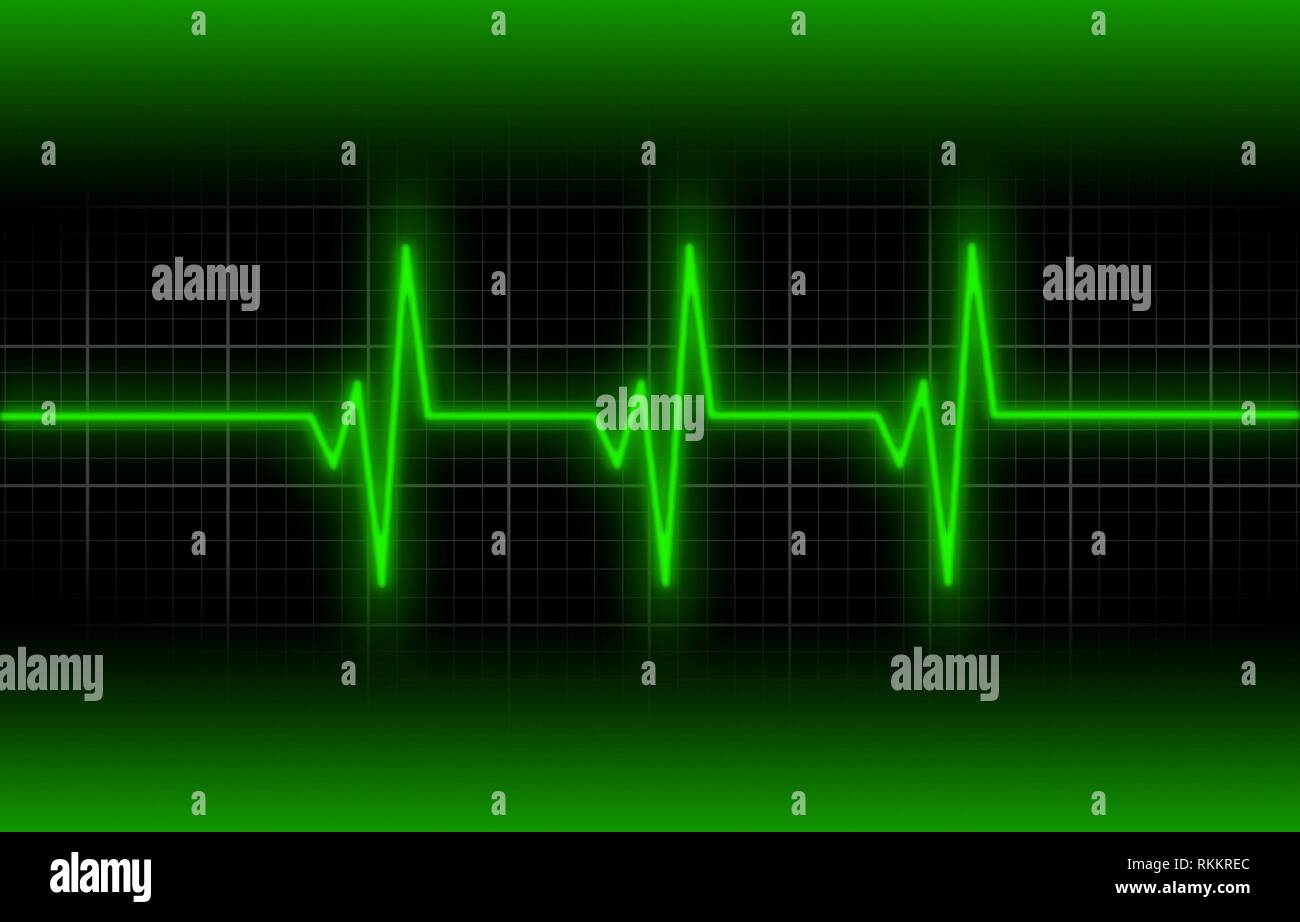 Human heart beat trace monitor hi-res stock photography and images - Alamy