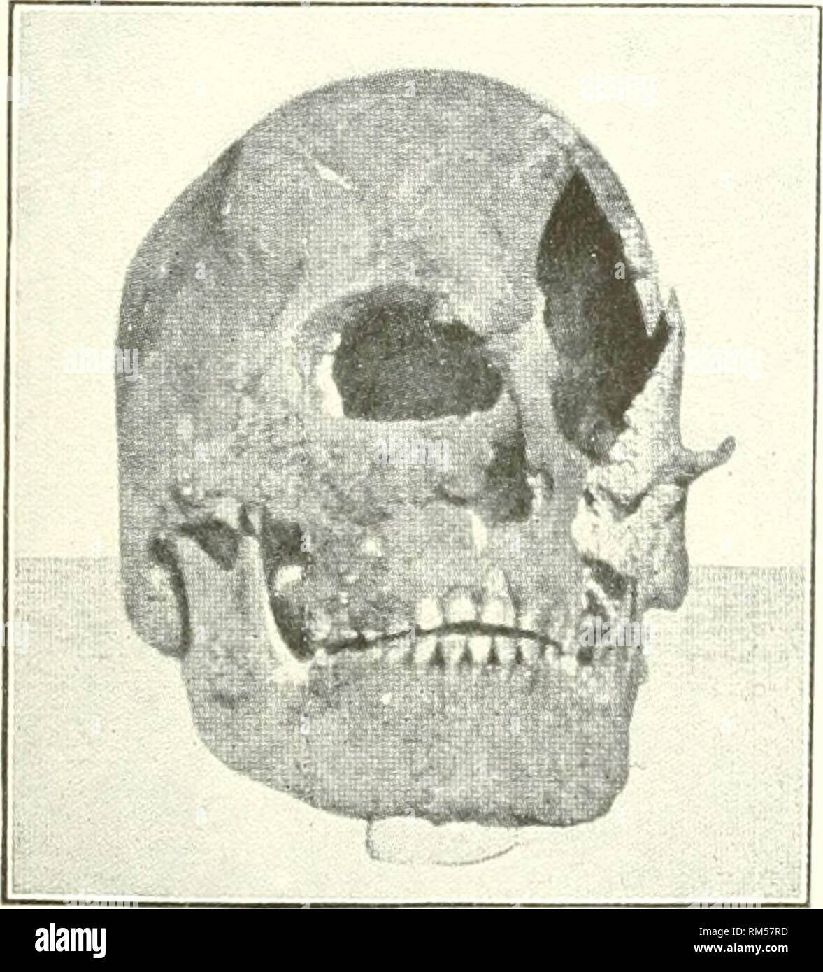 Cro magnon skull hi-res stock photography and images - Alamy