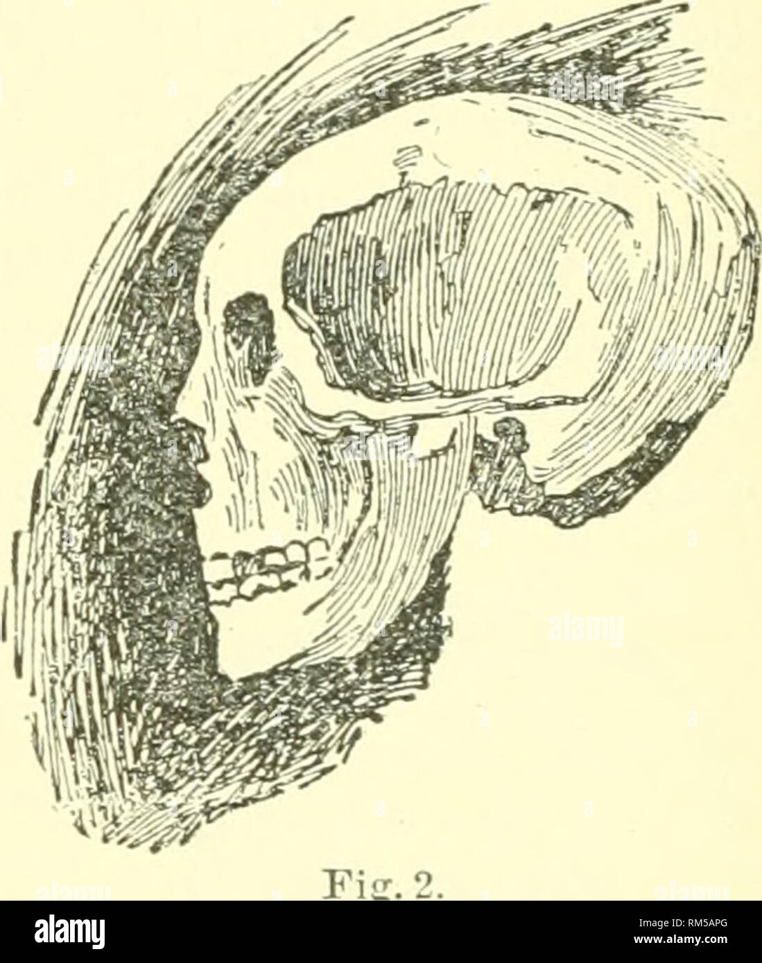 Dolichocephalic hi-res stock photography and images - Alamy