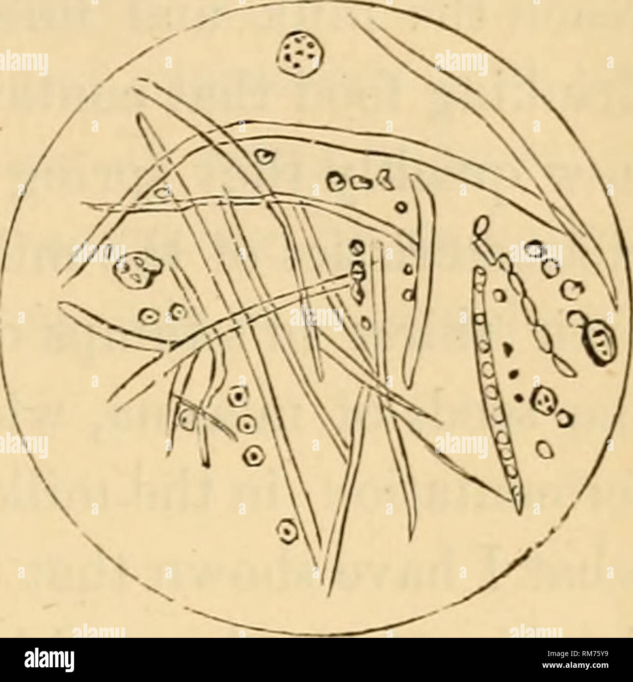 Pig blood sample hi-res stock photography and images - Alamy