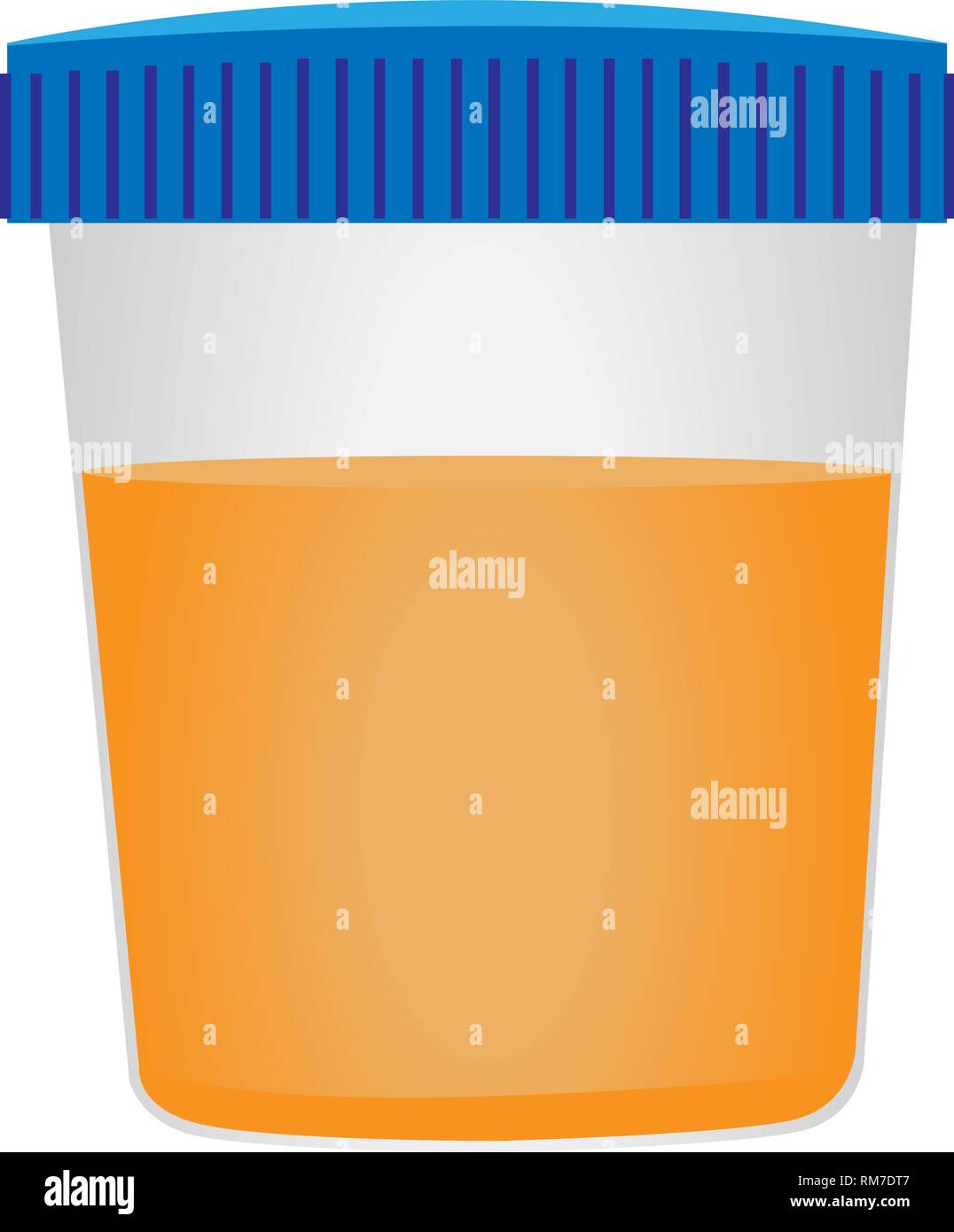 Urine alysis. Medical test and biological examination i a lab Stock ...