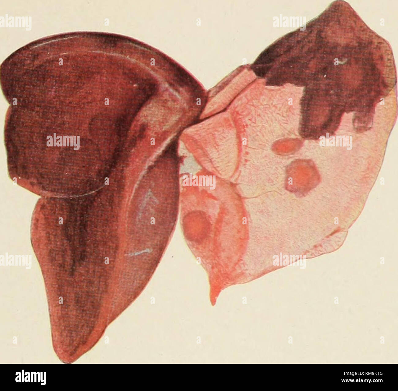 Pneumonic plague hi-res stock photography and images - Alamy