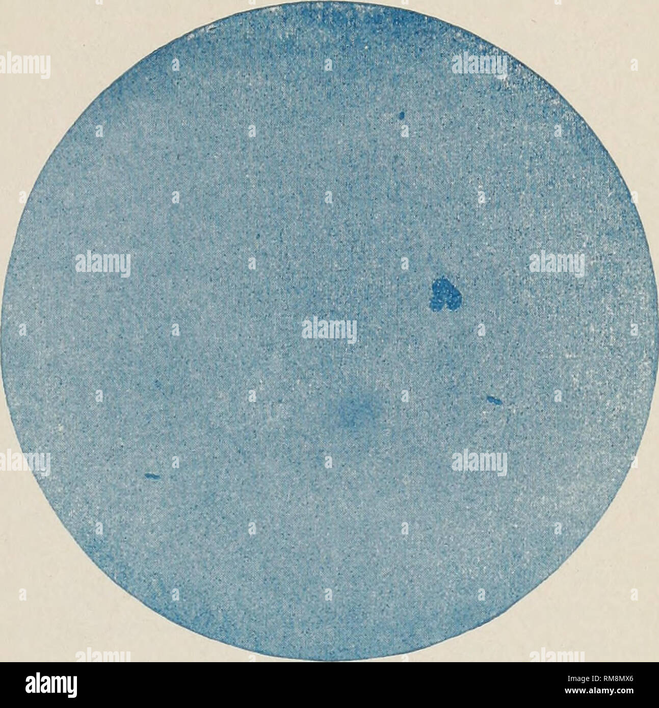 Lactic acid bacteria microscope hi-res stock photography and images - Alamy