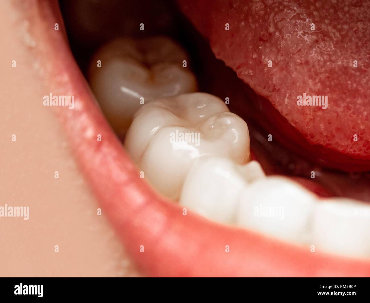Perfect teeth hi-res stock photography and images - Alamy