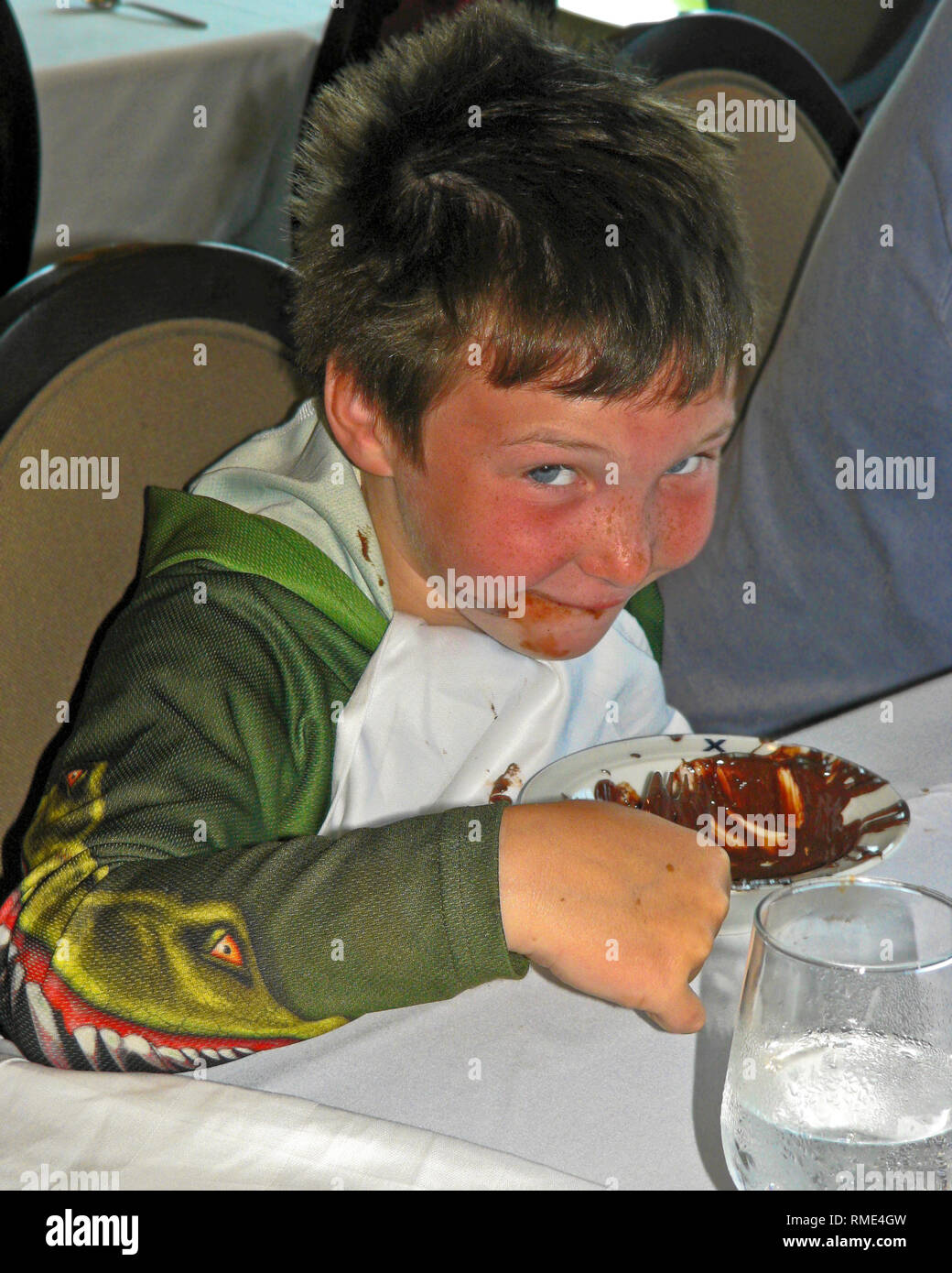 Child skin sunburned hi-res stock photography and images - Alamy