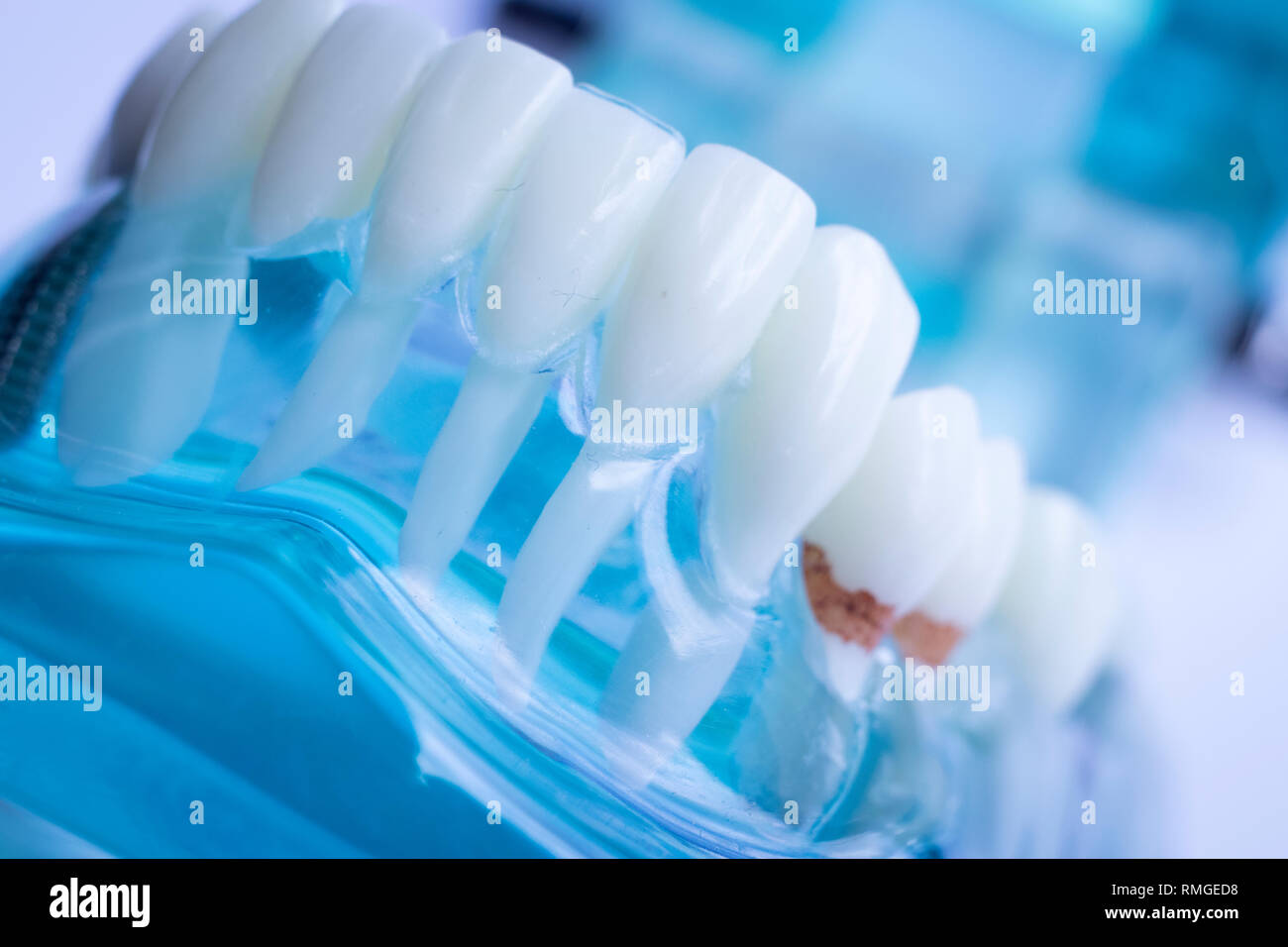 Dentist dental teeth teaching model showing each tooth and gum for ...