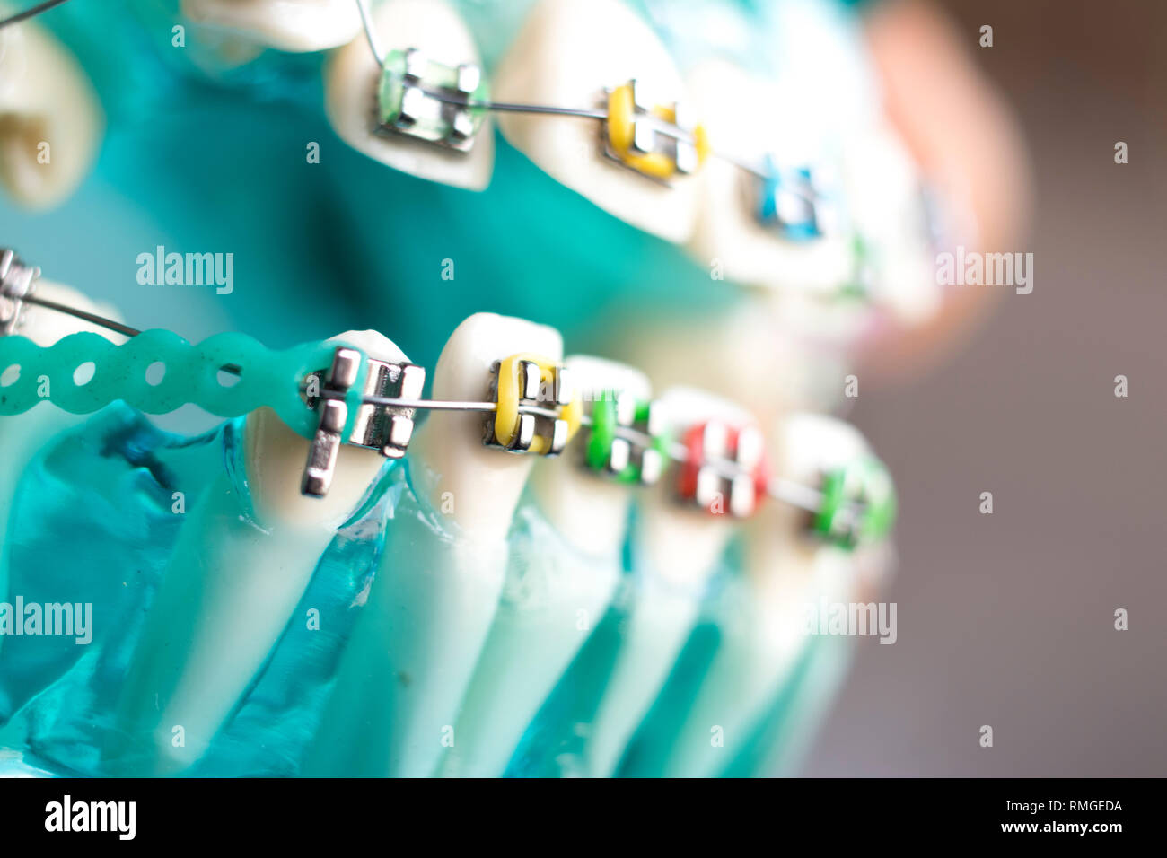 Dental metal braces teeth retainer aligners teaching orthodontics model ...