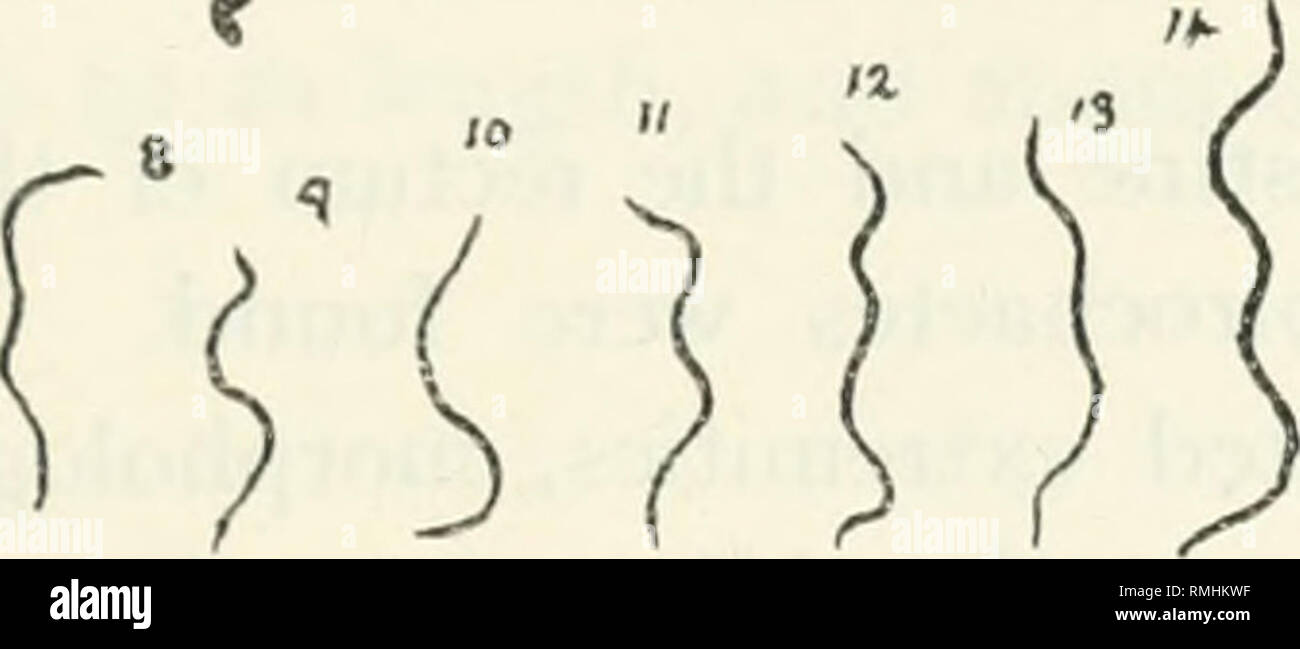Large intestine camera hi-res stock photography and images - Alamy