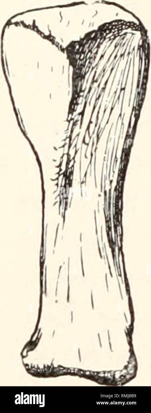 Shattered bone hi-res stock photography and images - Alamy