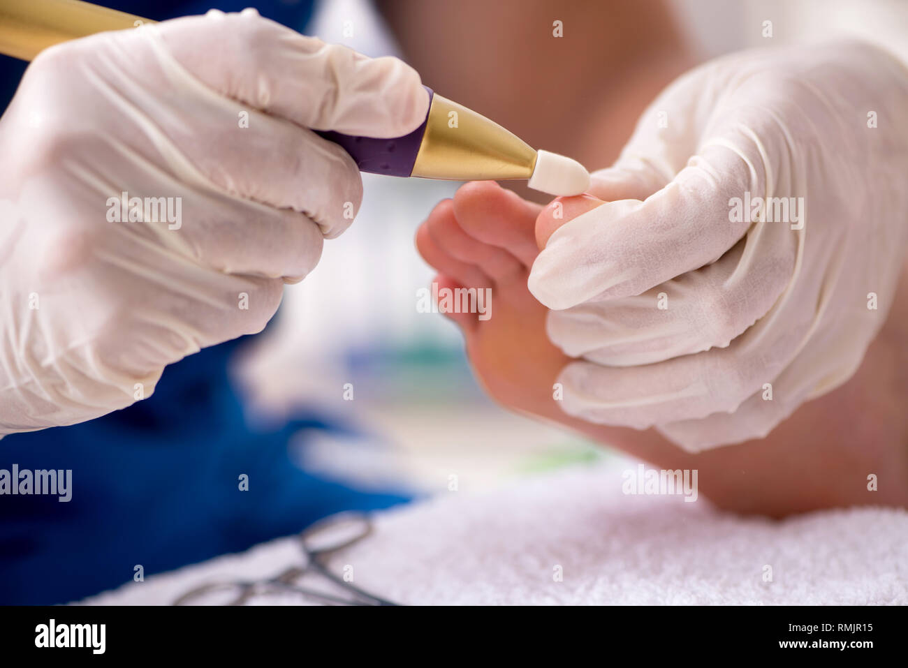 Podiatrist treating feet during procedure Stock Photo - Alamy