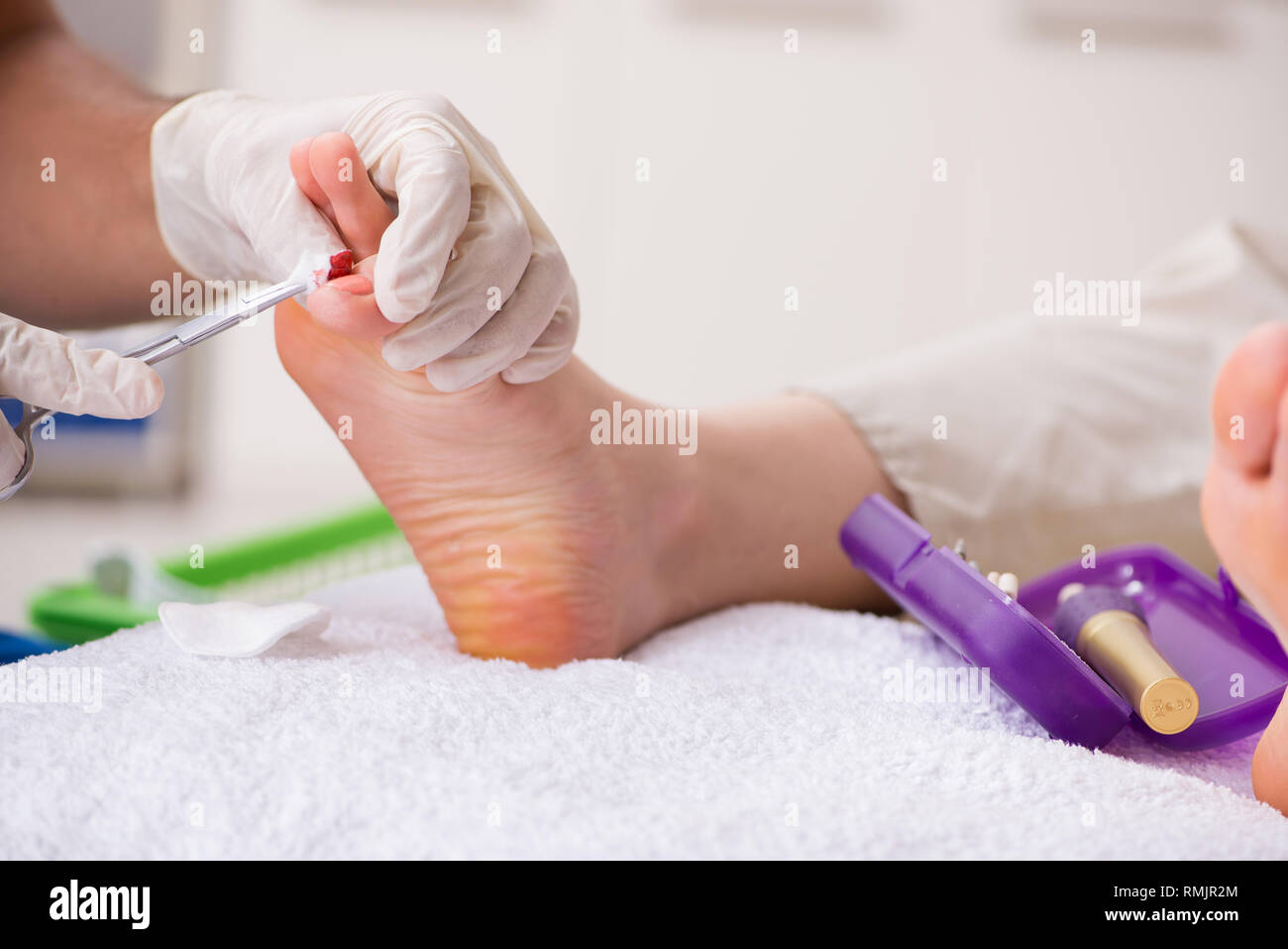 Podiatrist treating feet during procedure Stock Photo - Alamy