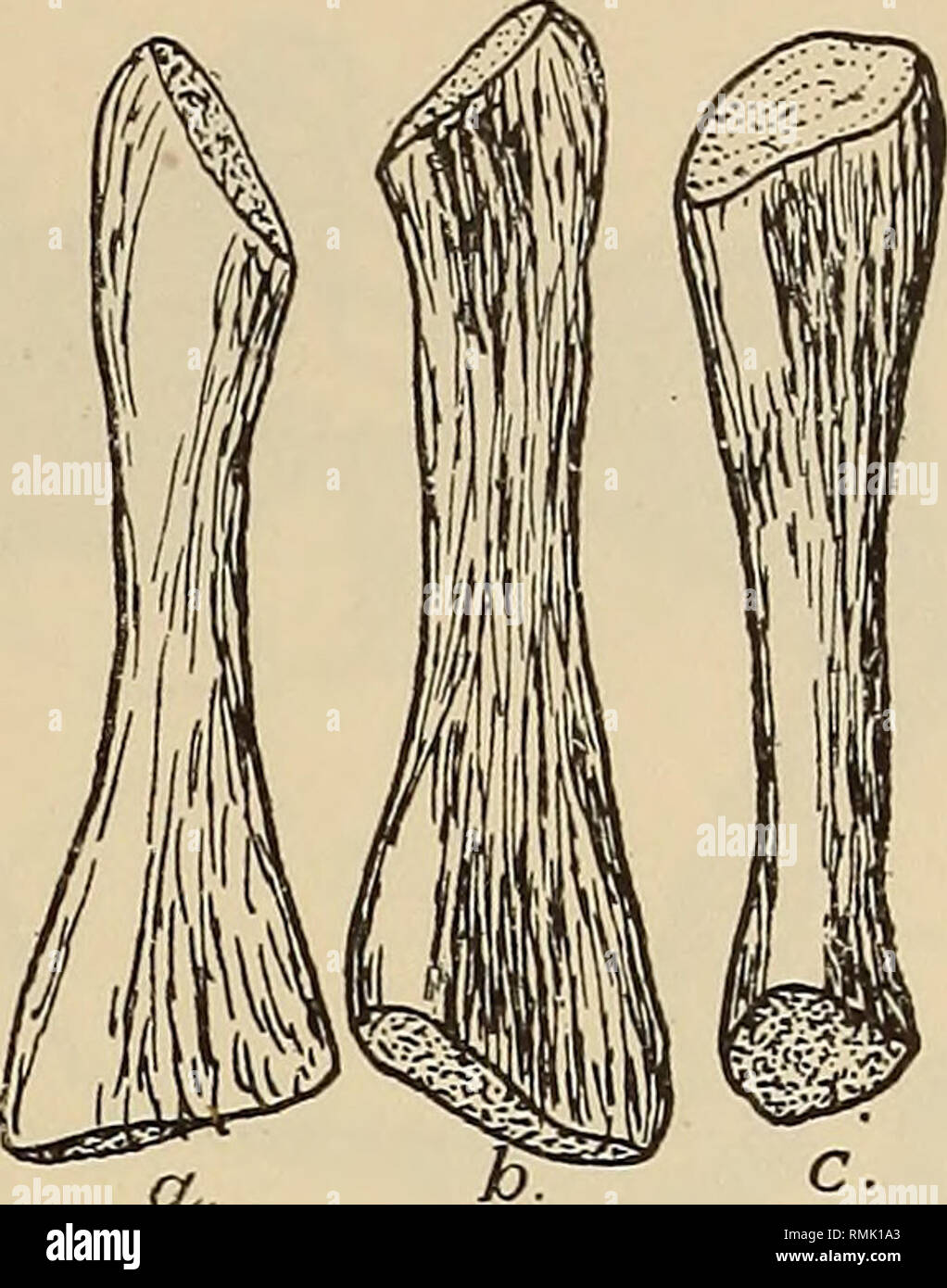 Preaxial hi-res stock photography and images - Alamy