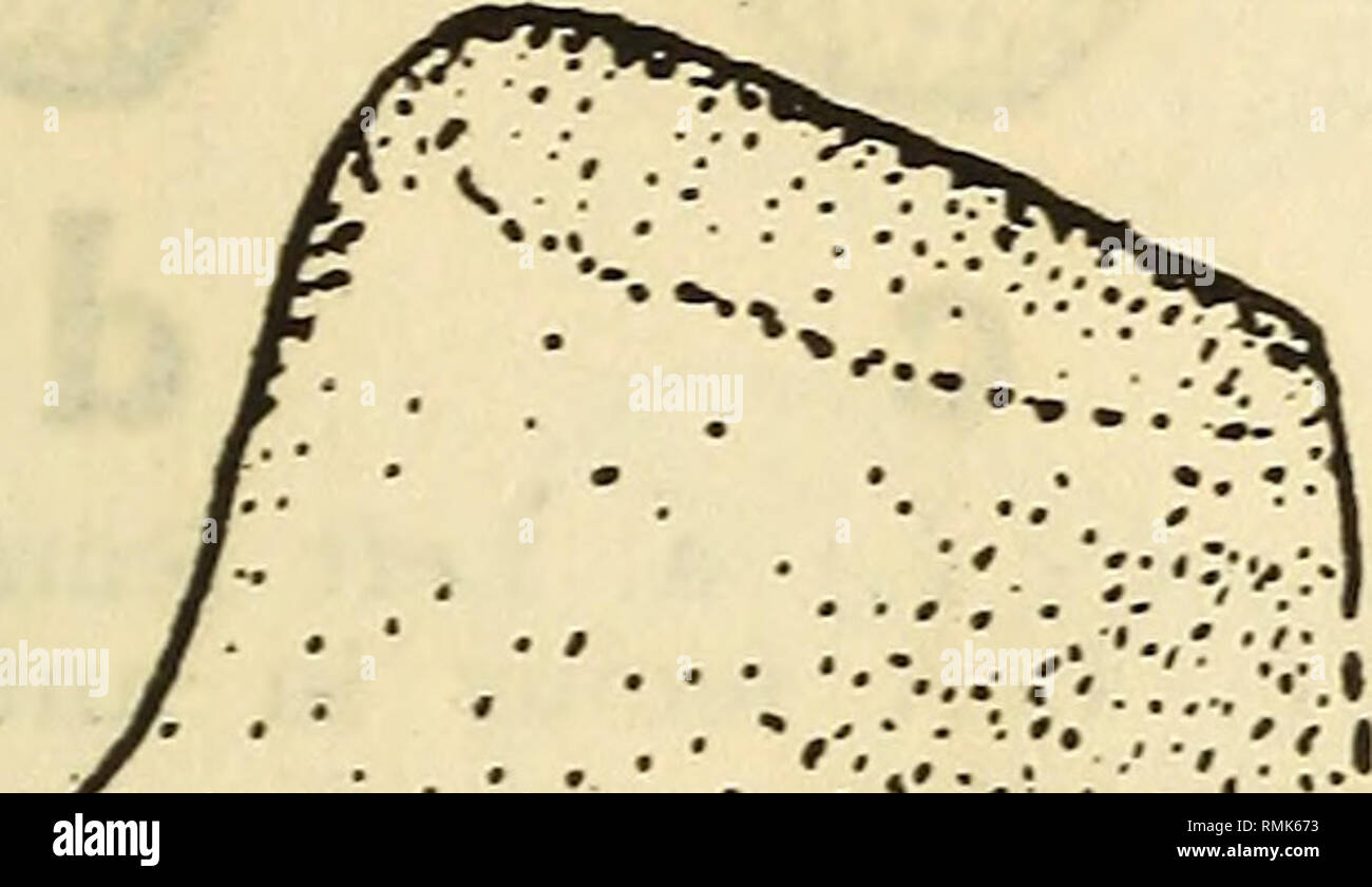 Distorted pelvis hi-res stock photography and images - Alamy