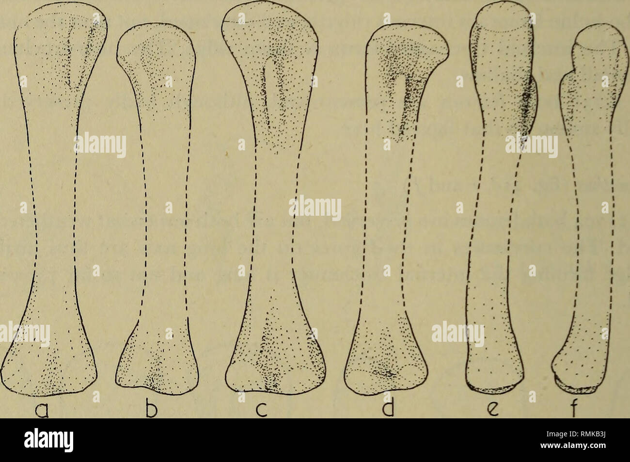 Intertrochanteric ridge hi-res stock photography and images - Alamy