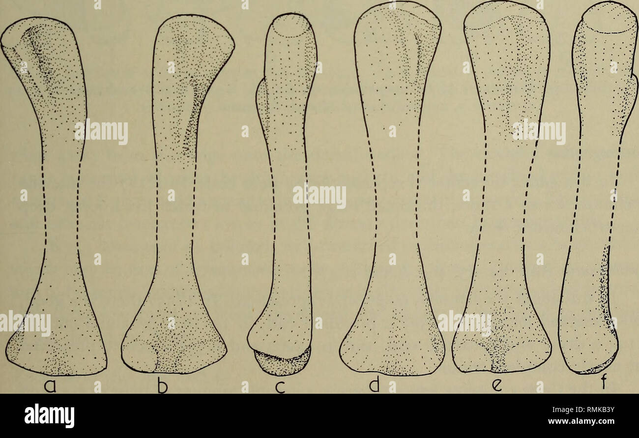 Femoral shaft hi-res stock photography and images - Alamy