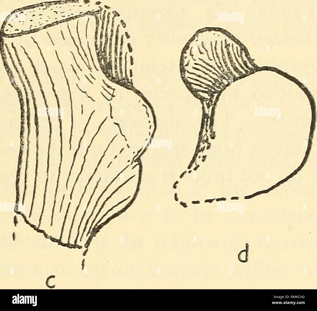 Inter trochanteric hi-res stock photography and images - Alamy