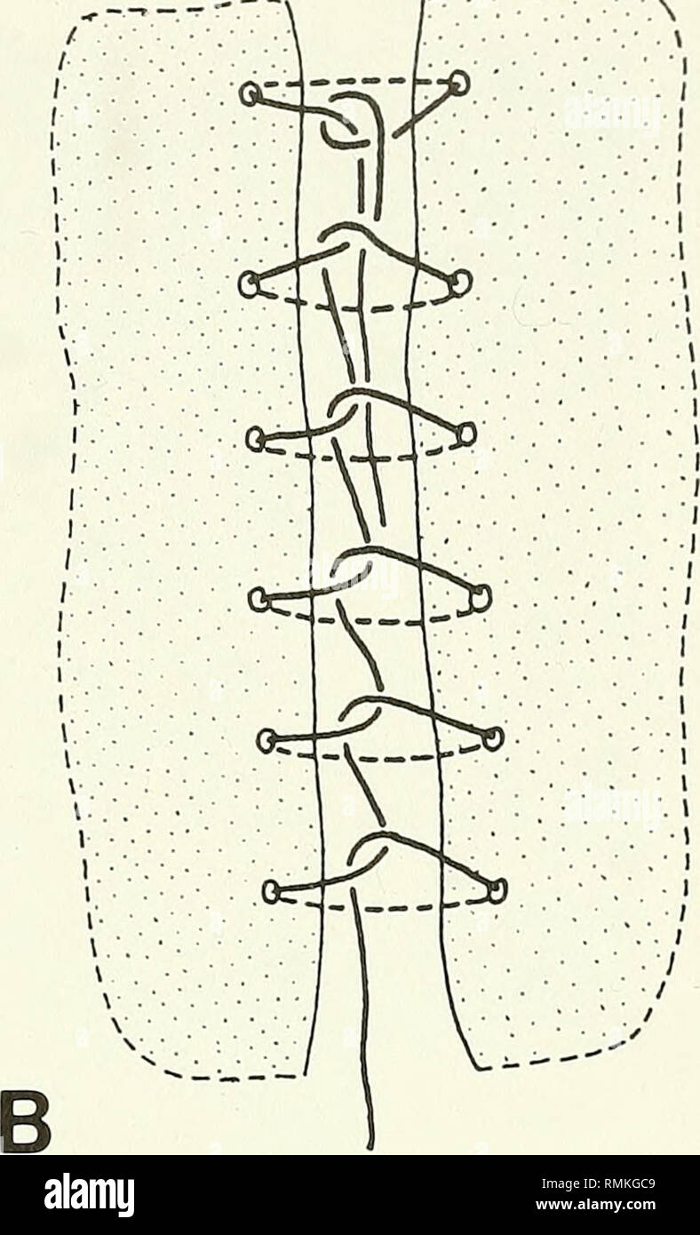 Softening Skins High Resolution Stock Photography and Images - Alamy