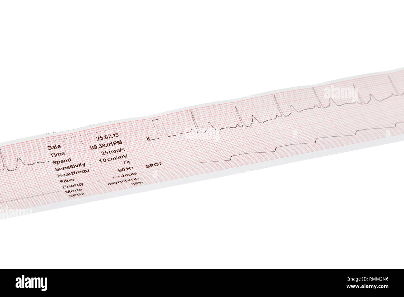 Cardiac cardiogram hi-res stock photography and images - Alamy