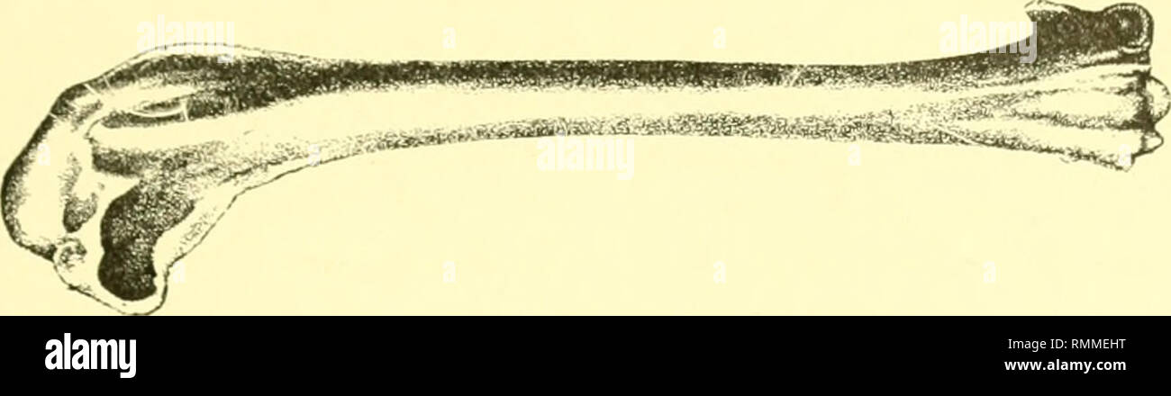 Radial fossa hi-res stock photography and images - Alamy