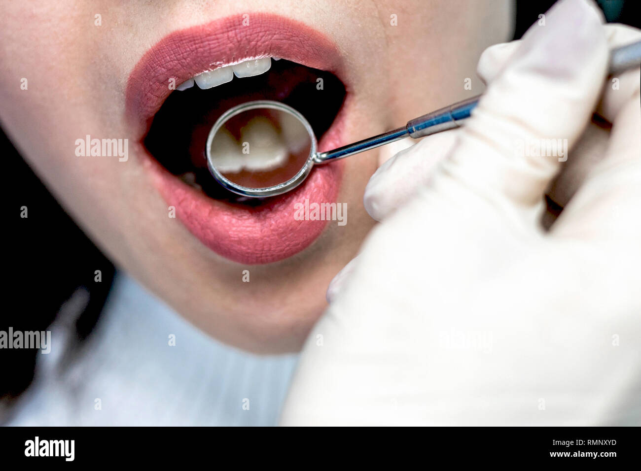 Patient open mouth during oral checkup by dentist Stock Photo - Alamy
