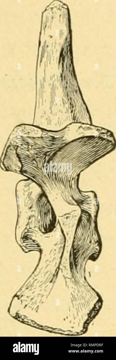 Transverse processes of cervical vertebrae hi-res stock photography and ...