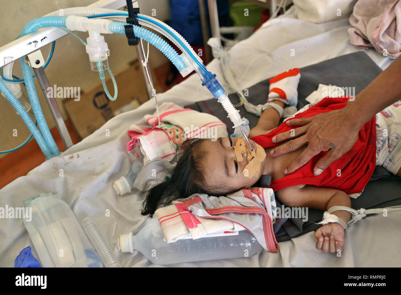 Manila, Philippines. 15th Feb, 2019. A Filipino child suffering from ...