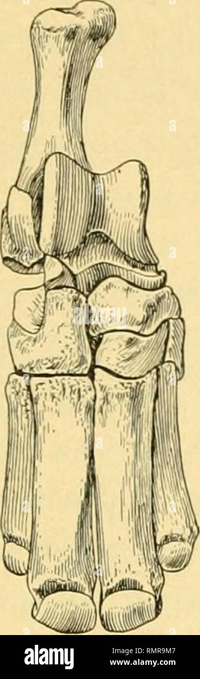 Well pit type hi-res stock photography and images - Alamy