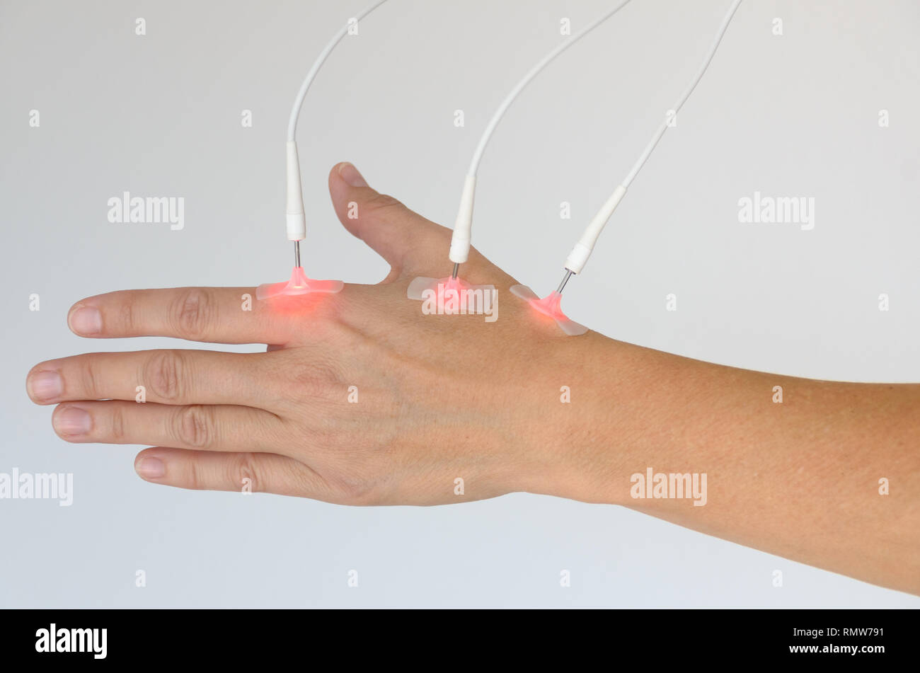 Ems stimulation hi-res stock photography and images - Alamy