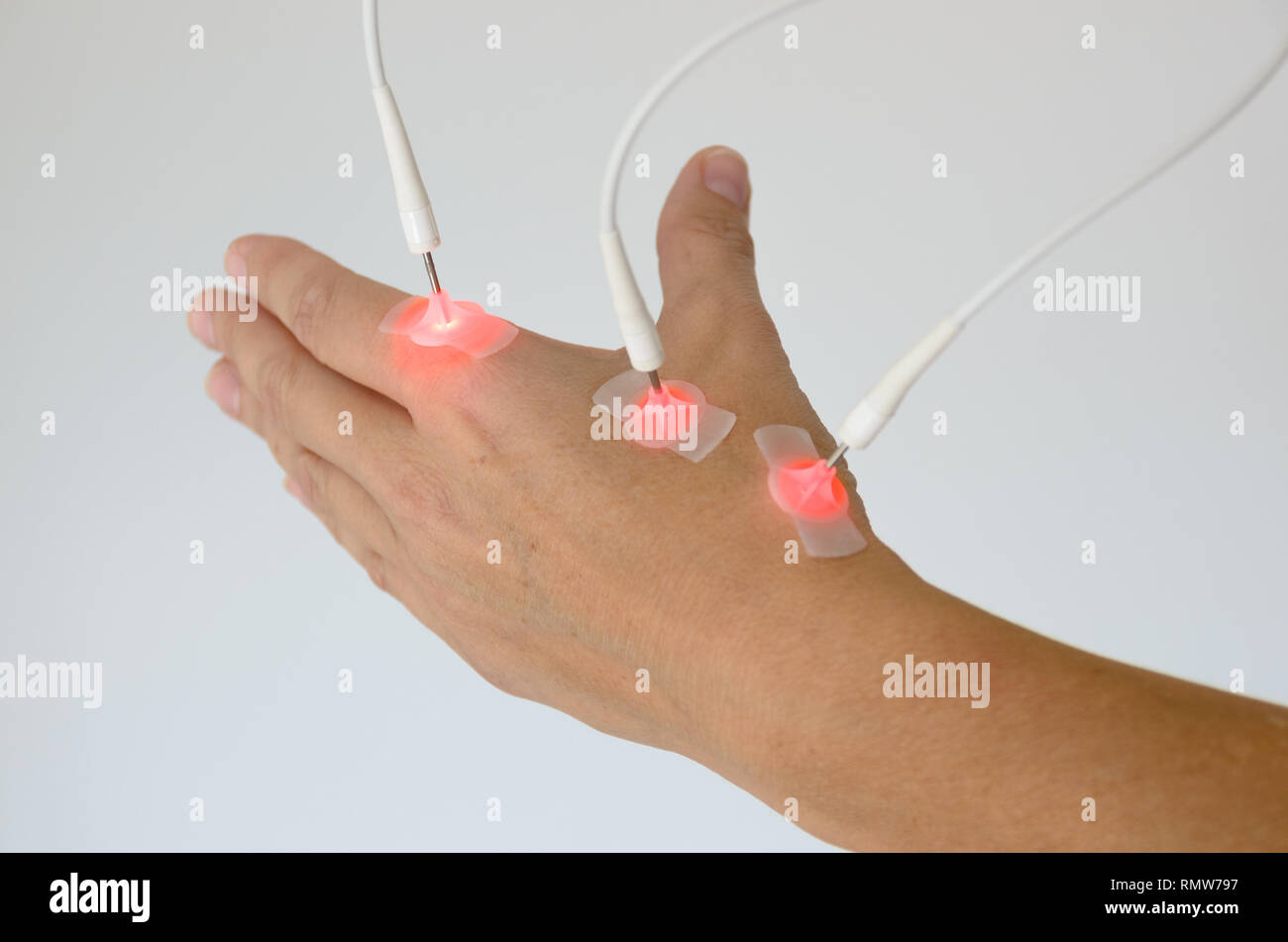 Therapeutical hi-res stock photography and images - Alamy