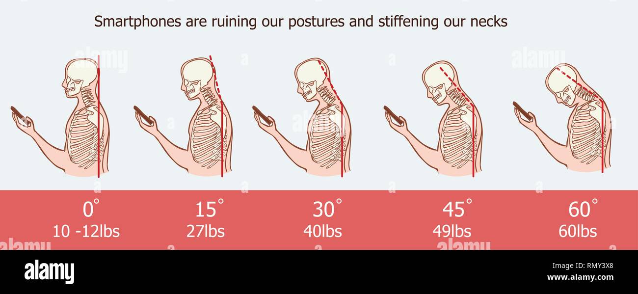 Human neck bending Stock Vector Images - Alamy