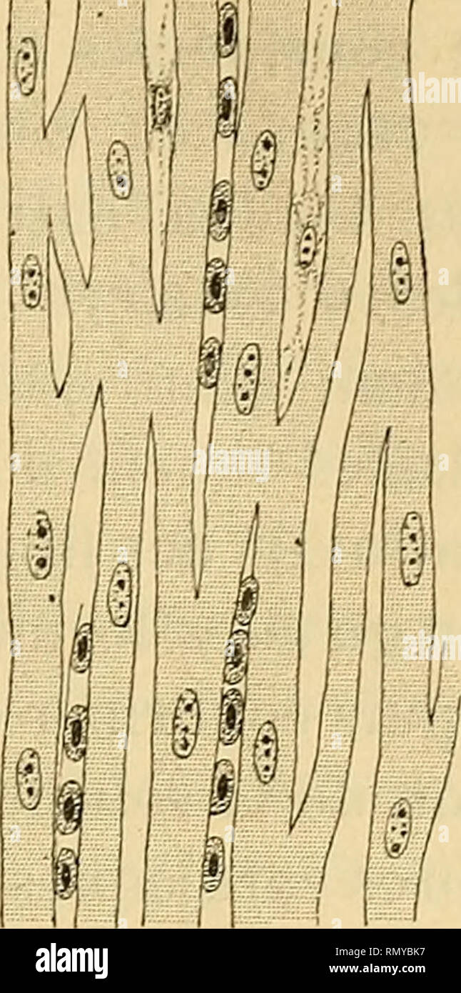 Muscle papillaire hi-res stock photography and images - Alamy