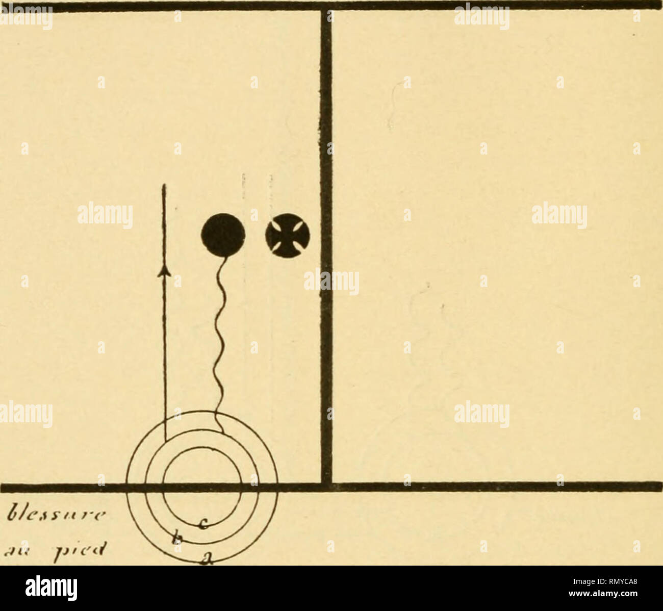 Contuse hi-res stock photography and images - Alamy