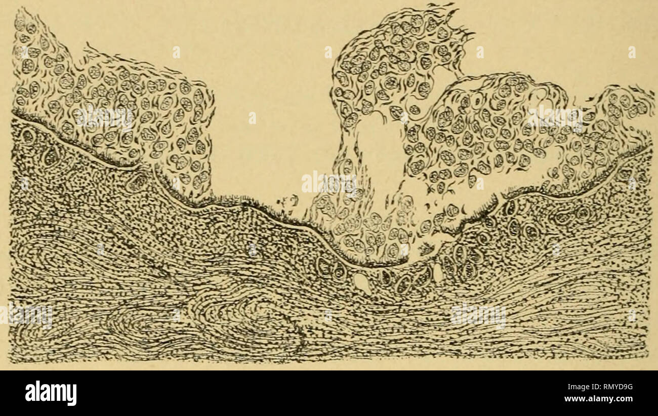 14 ans et plus hi-res stock photography and images - Alamy