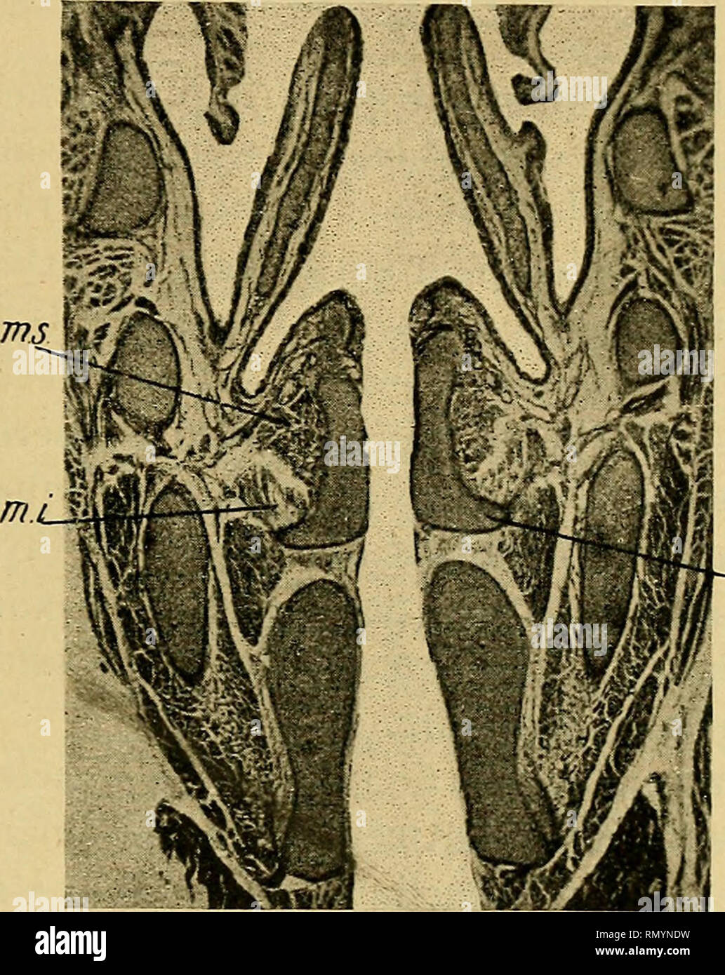 Amygdale hi-res stock photography and images - Alamy