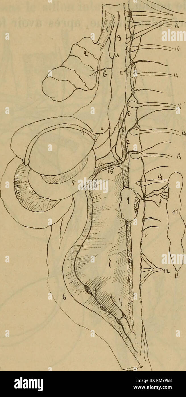 Aorte abdominale hi-res stock photography and images - Alamy
