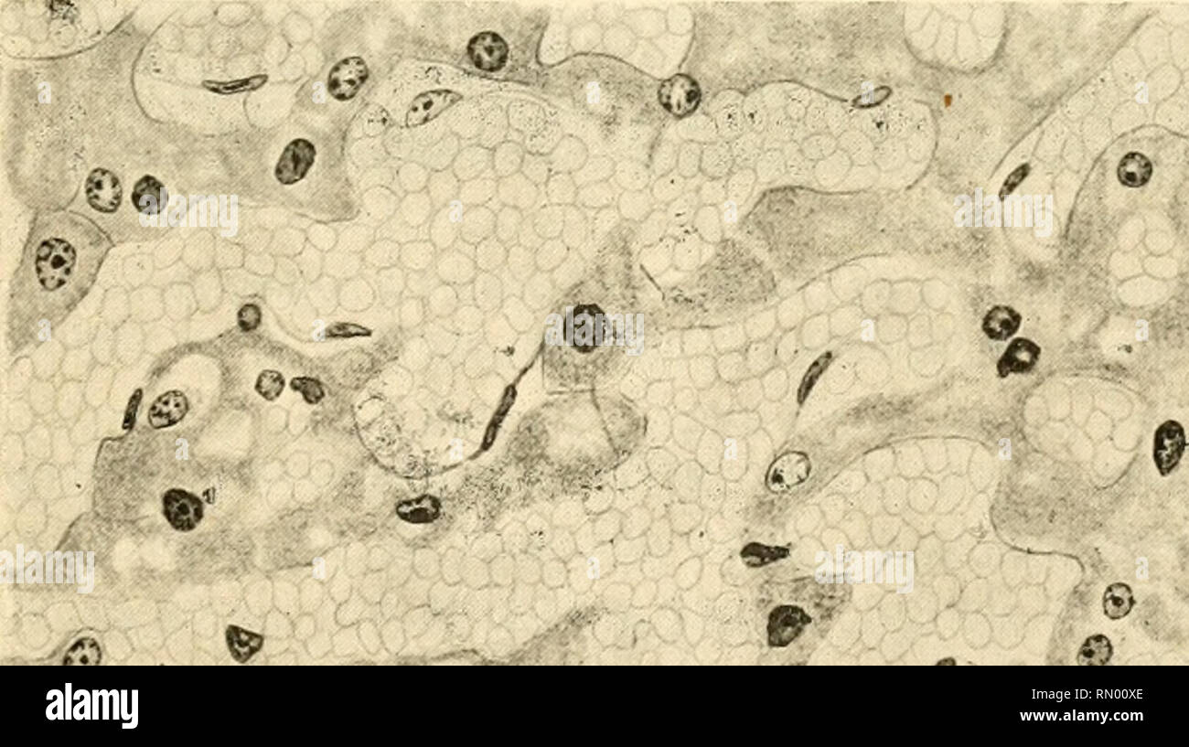 Nécrose cutanée hi-res stock photography and images - Alamy