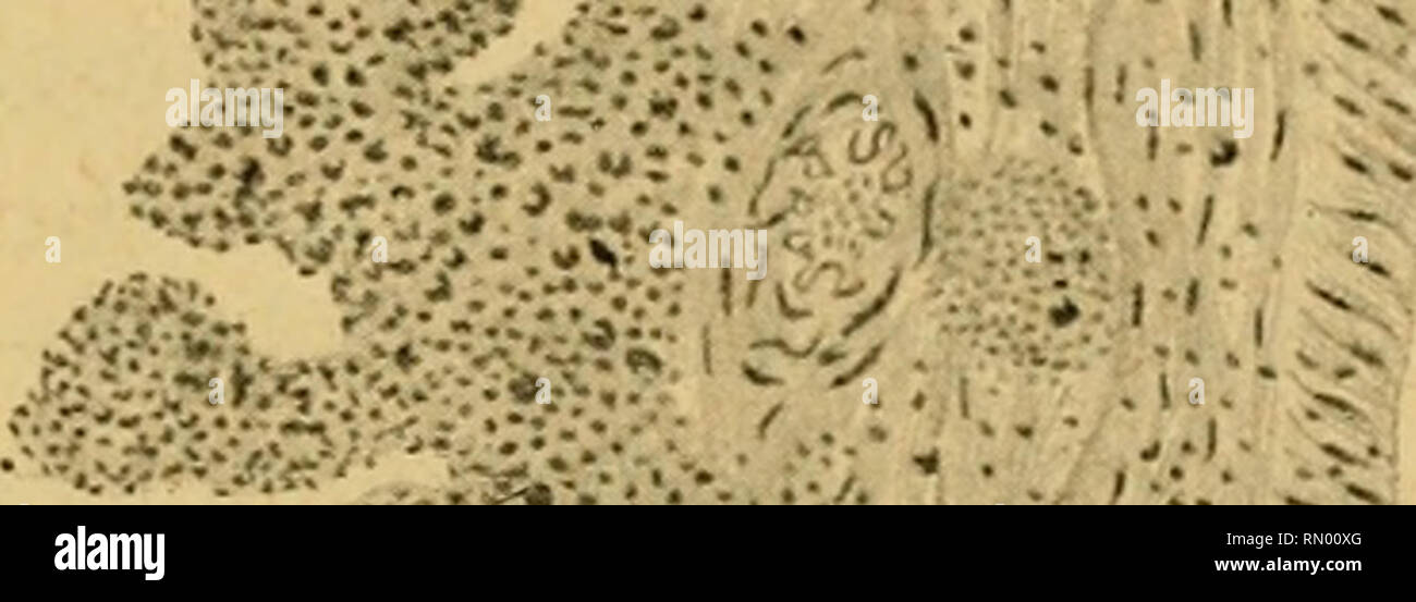 Muqueuse du colon hi-res stock photography and images - Alamy