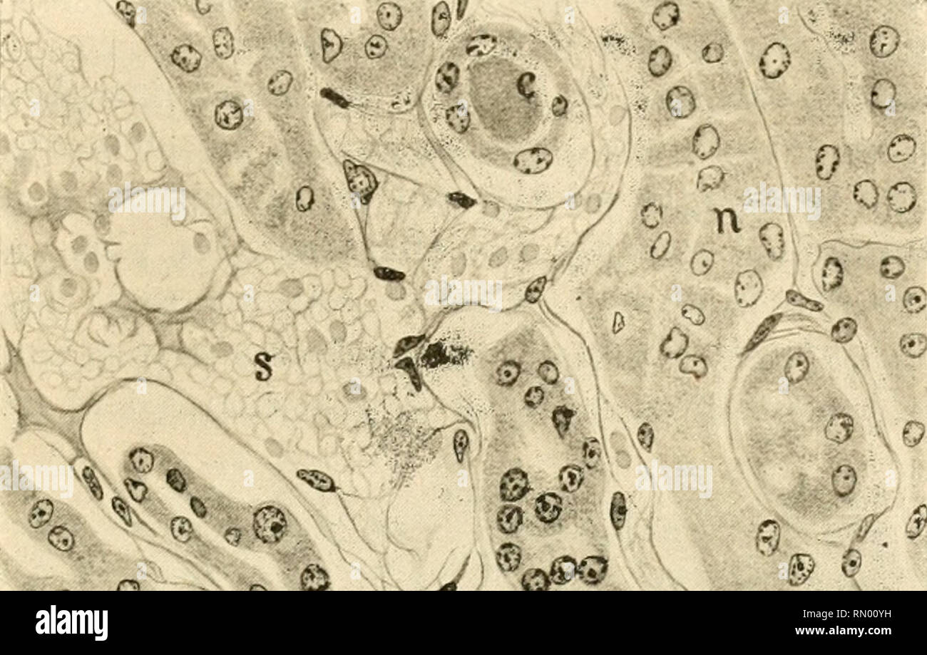 Nécrose cutanée hi-res stock photography and images - Alamy