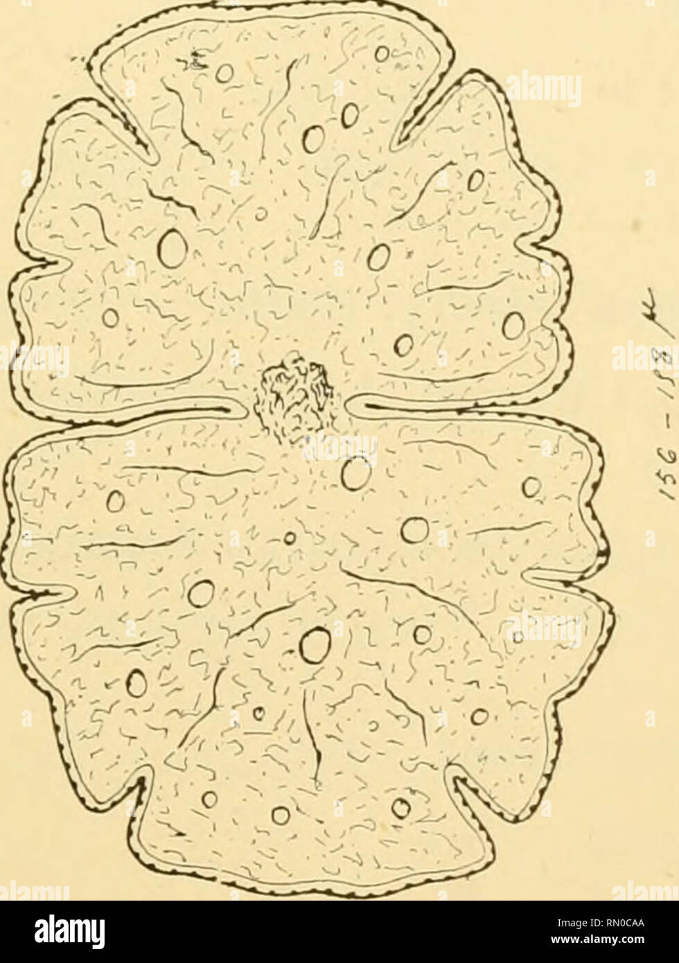 Membrane plaque hi-res stock photography and images - Alamy