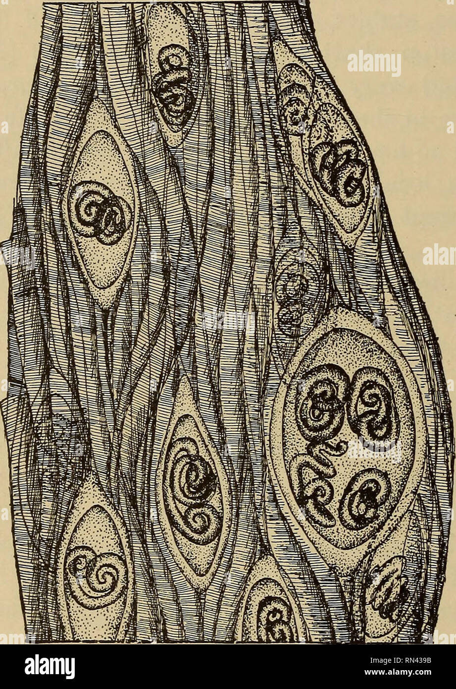 Trichinella spiralis hi-res stock photography and images - Alamy
