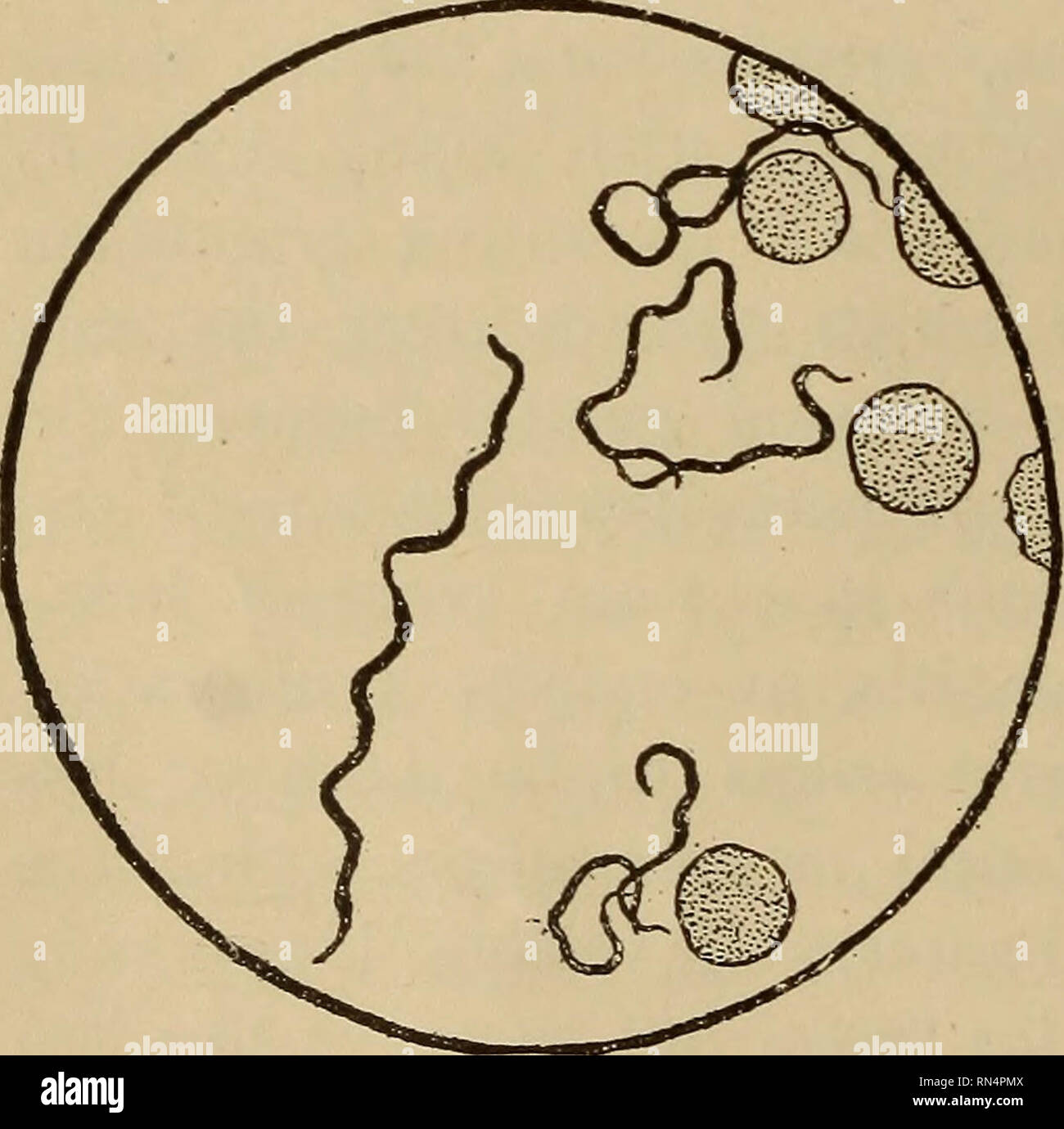 Yaws High Resolution Stock Photography and Images - Alamy